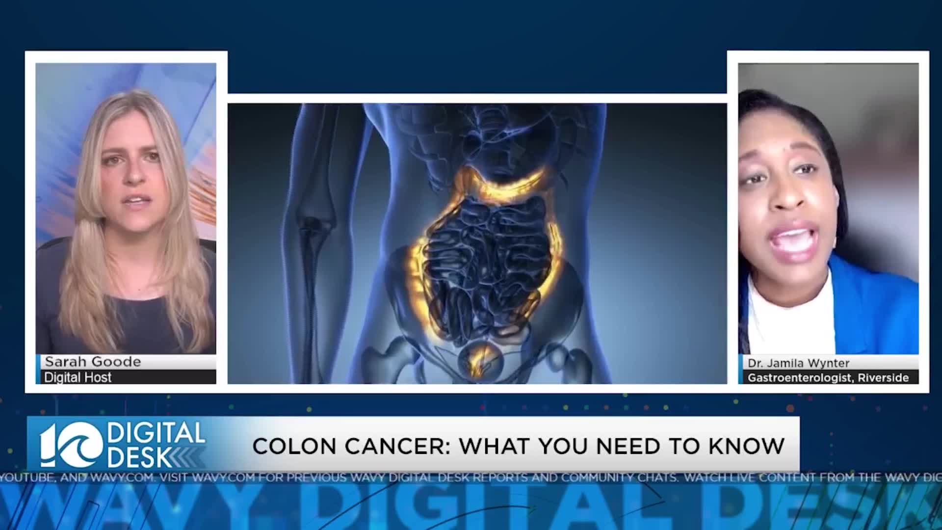 Local doctor speaks about racial disparities in colon cancer – WAVY.com