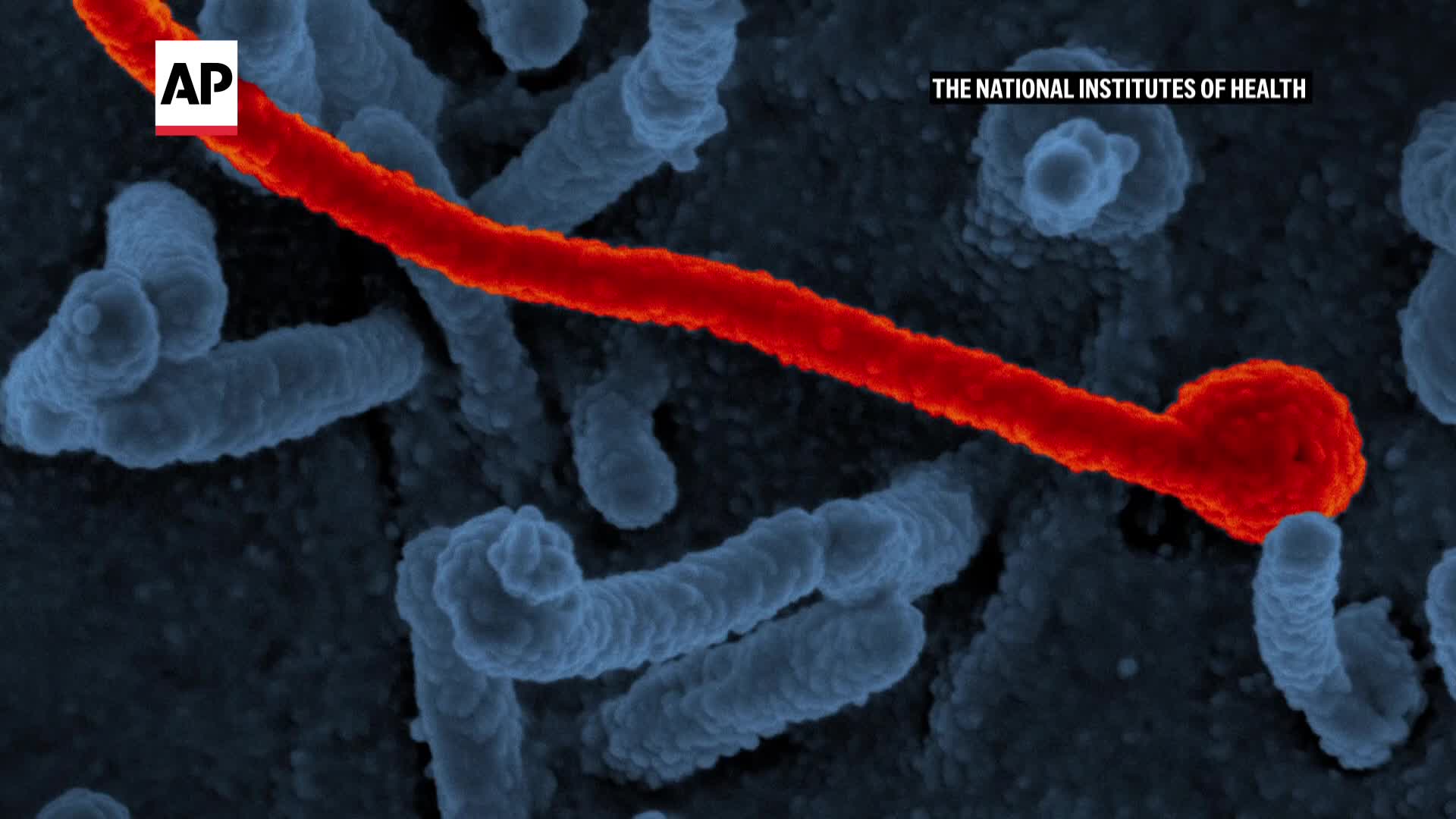 Ebola: What you should know – KSN-TV